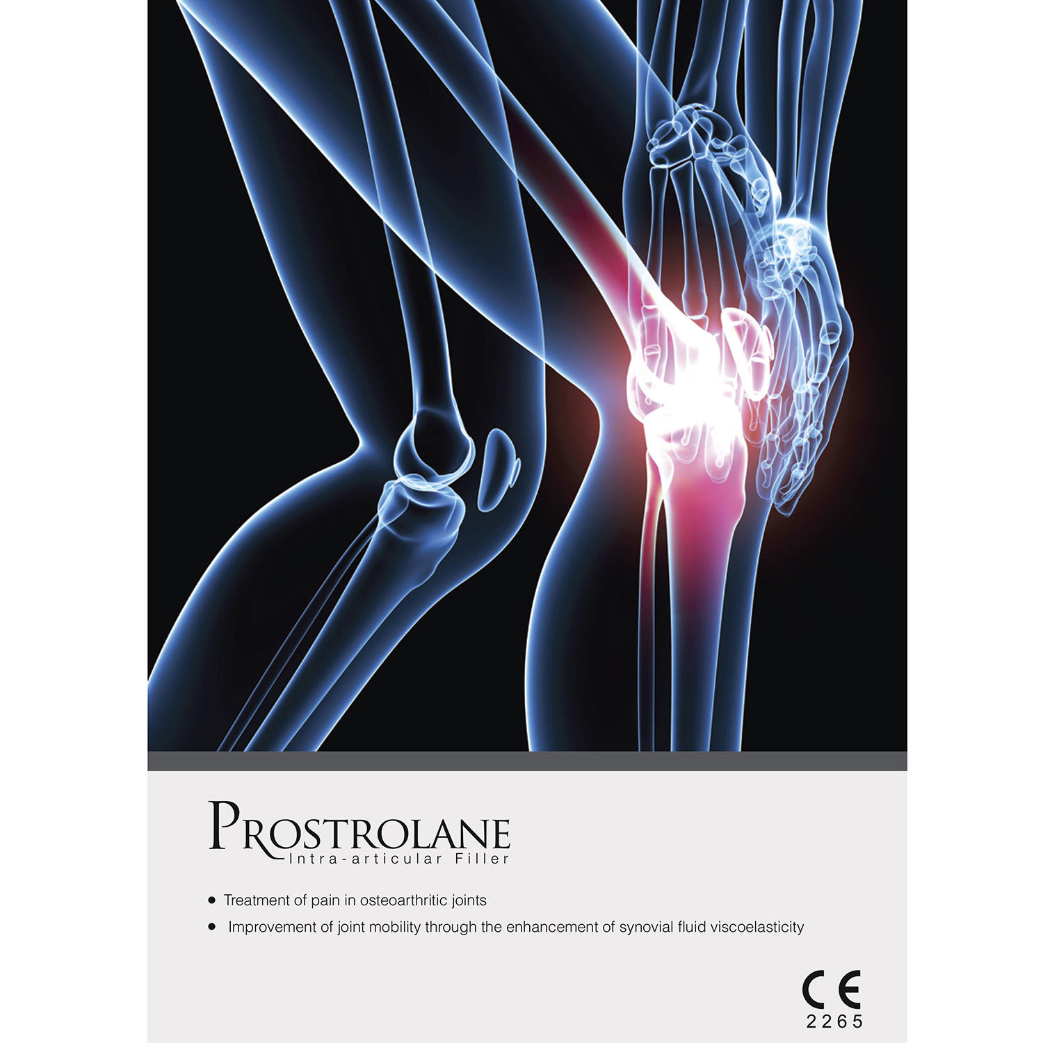 Prostrolane Intra-Articular Filler® | Knee Injection | Peptide Therapy ...