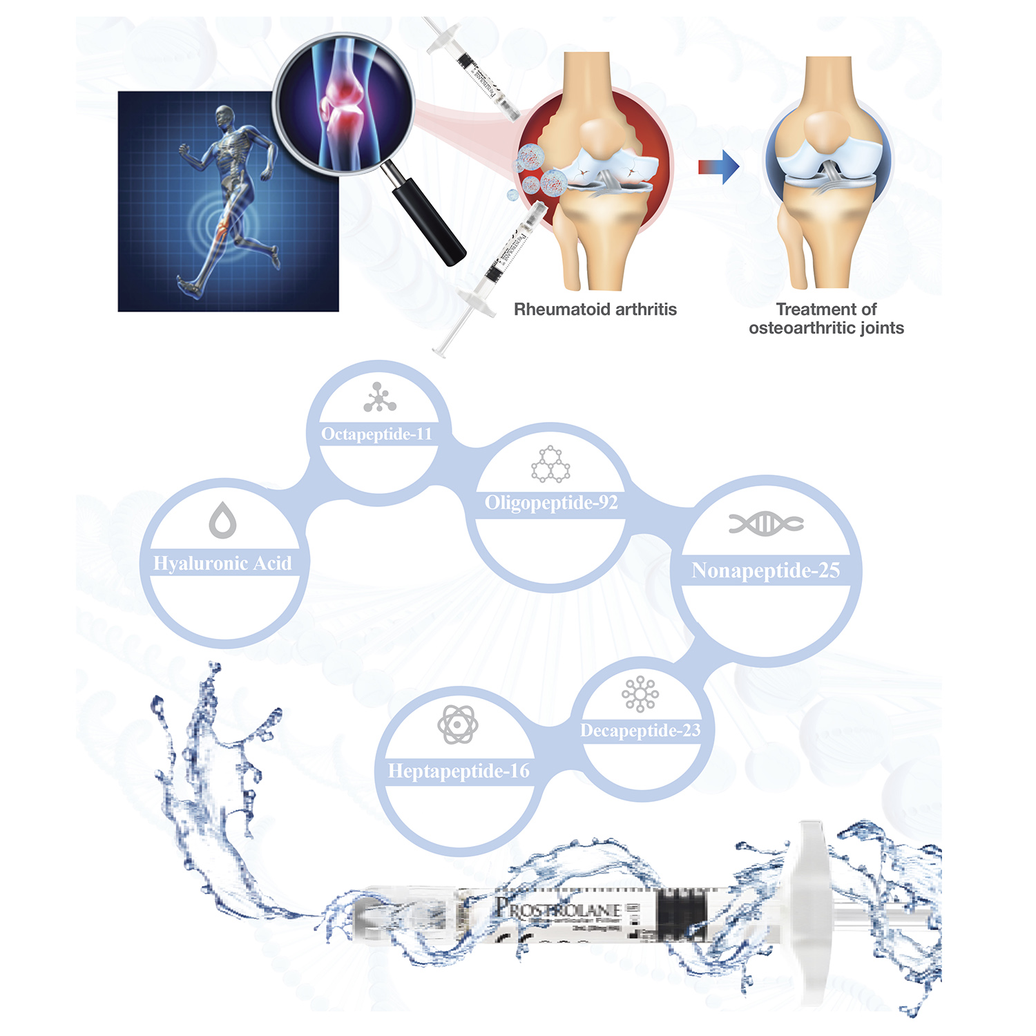 Prostrolane Intra-Articular Filler® | Knee Injection | Peptide Therapy ...